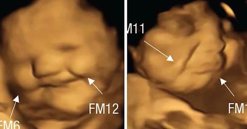 Babies in the womb 'smile' and 'cry' in reaction to what mum eats ...
